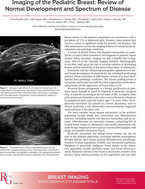 Imaging Of The Pediatric Breast Review Of Normal Development And