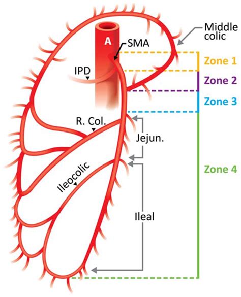 Vasculitis Of Superior Mesenteric Artery Sma Branches