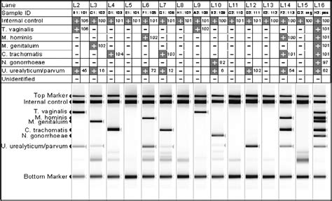 Figure 1 From Direct Simultaneous Detection Of 6 Sexually Transmitted Pathogens From Clinical