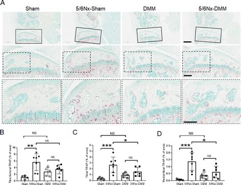 Tartrate Resistant Acid Phosphatase Trap Staining A Trap Staining Download Scientific