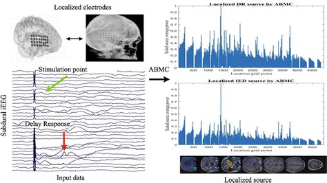 Do Interictal Epileptiform Discharges And Brain Responses To Electrical Stimulation Come From