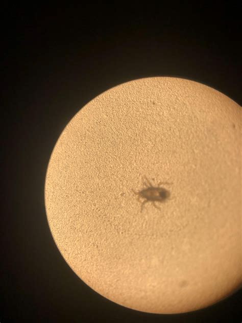 Identify This Microscope Image Of Bug R Whatsthisbug