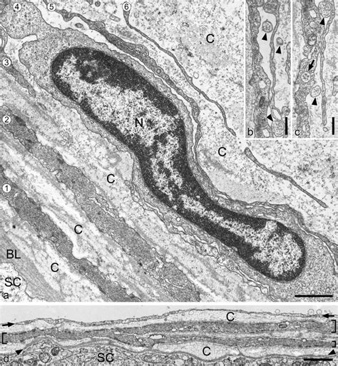 Electron Micrographs Of Ultrathin Cross Sections Through The Peripheral