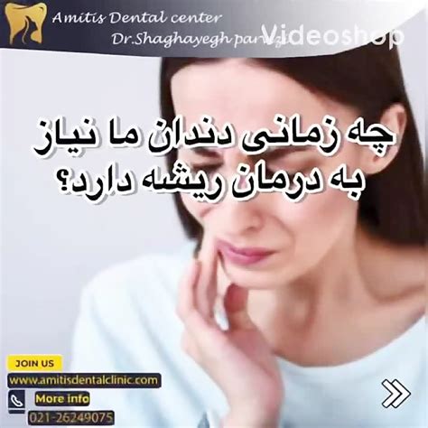 زمان درمان ریشه دندان یا عصب کشی