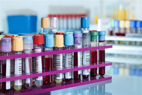 Mistakes To Avoid When Labeling Specimens