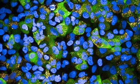 Accelerating Drug Discovery The Impact Of Ultra Fast Screening Drug