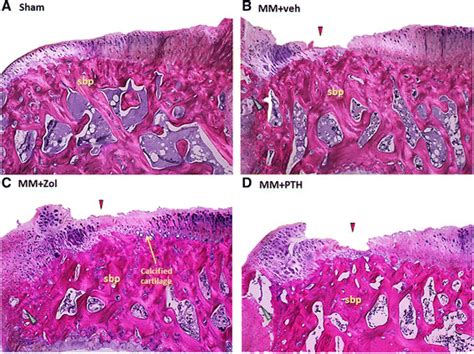 Polarized Light Picture Of The Proximal Tibial Epiphysis Stained With Download Scientific