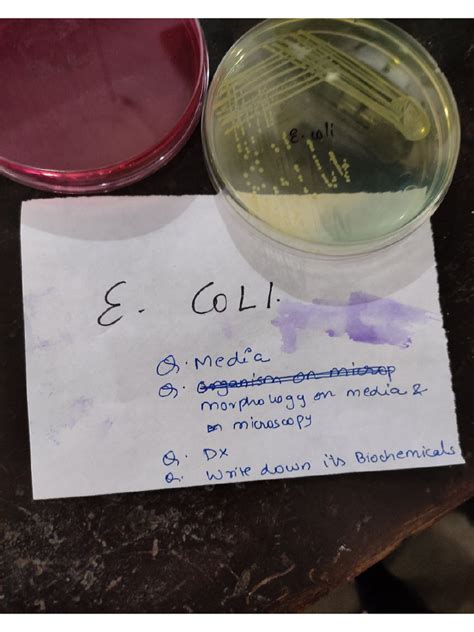 E Coli Pdf