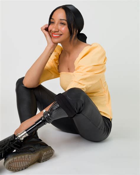 Zebedee Uk Zbd Talent Models With Disabilities Visible Differences And Trans And Non Binary