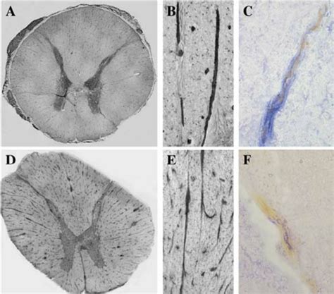Expression Of Htlv 1 Receptors Glut 1 And Np 1 In The Thoracic Spinal