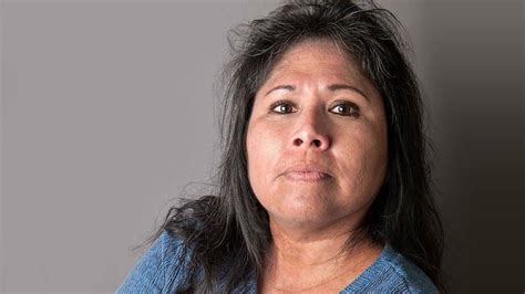 How To Cope With Scleroderma Symptoms More Than Scleroderma