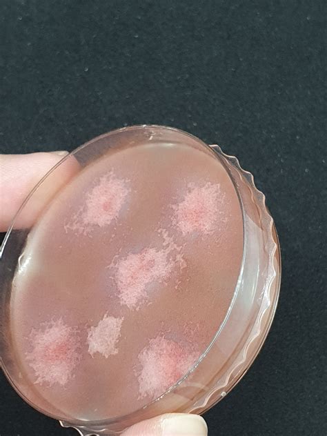 Ku Mold Instance Segmentation Dataset By Yuyoung