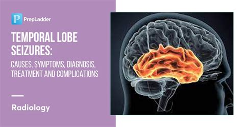 temporal lobe seizures causes treatment and complications