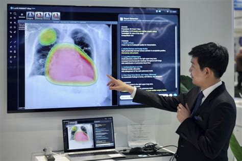 의료 챗 Gpt 탄생 성큼한국도 잰걸음