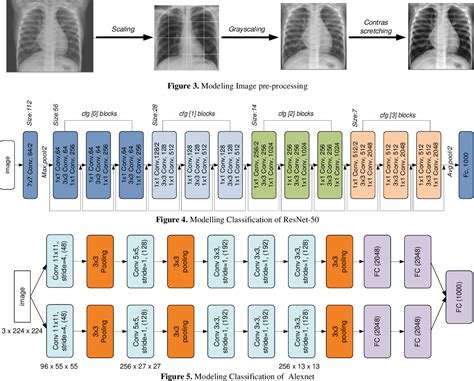 Figure 1 From Pneumonia Classification Of Thorax Images Using Convolutional Neural Networks
