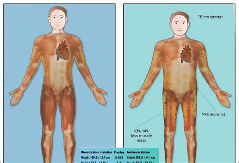 Schematic Depicting Body Size And Composition Differences Between