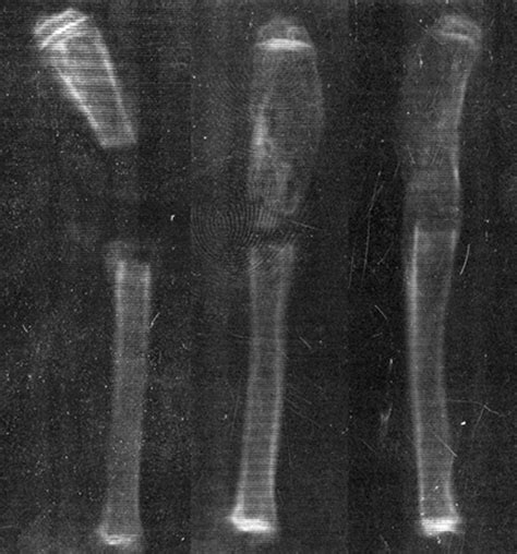 Healing Of The Critical Size Bone Defects A No Bone Formation Download Scientific Diagram
