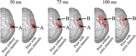 Comparison Of Eeg Reconstruction In Fig 11 And Eeg Reconstruction