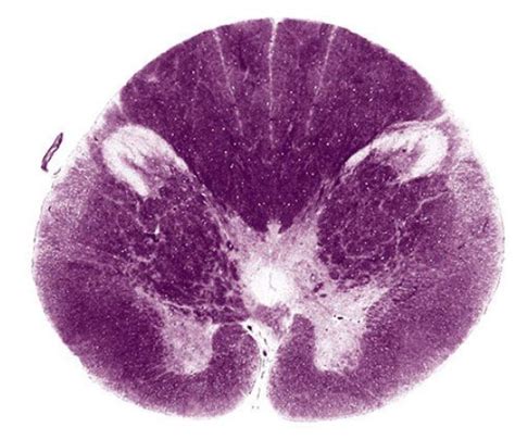C1 Médula Diagram Quizlet