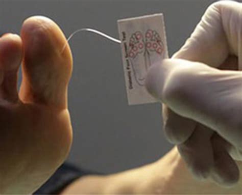 Monofilaments Aandd Medical