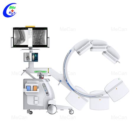 China X Ray System C Arm X Ray Machine Manufacturers X Ray System C