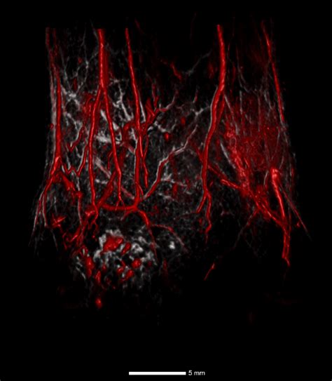 Tritom Vasculature Scintica