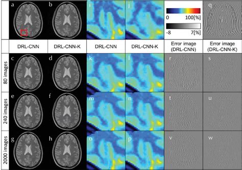 Figure 1 From Reconstruction Of Compressed Sensing Mr Imaging Using