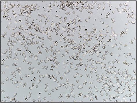 Urine Under Microscope At Laura Granados Blog