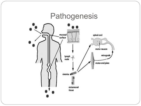 Poliomyelitis Pptx Lung And Respiratory Health Diseases And