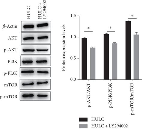 Overexpressing Hulc Enhanced The Malignant Behaviors Of Osteosarcoma Download Scientific