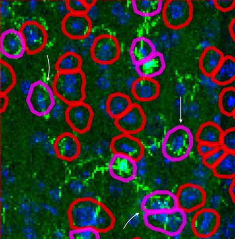 Object Classifier Not Including Cells Of Interest Image Analysis
