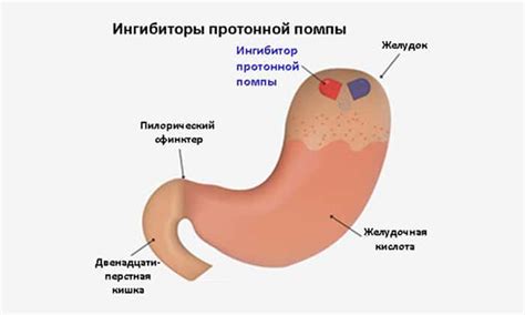 Дексилант: инструкция по применению 30 и 60 мг, отзывы, аналоги, цена