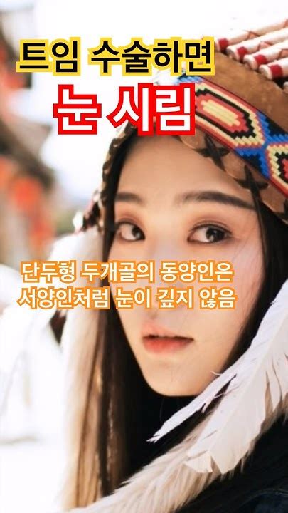 트임 수술하면 안되는 이유 눈 시림 Youtube