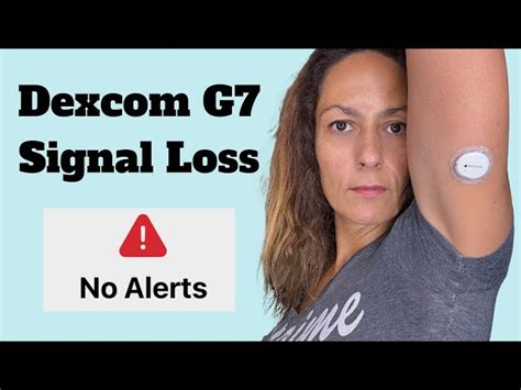 Dexcom G Troubleshooting Quick Fixes And Solutions Tpa Com