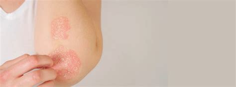 How Inflammation Affects Your Skin Gut And Joints Natural Wellness Lab