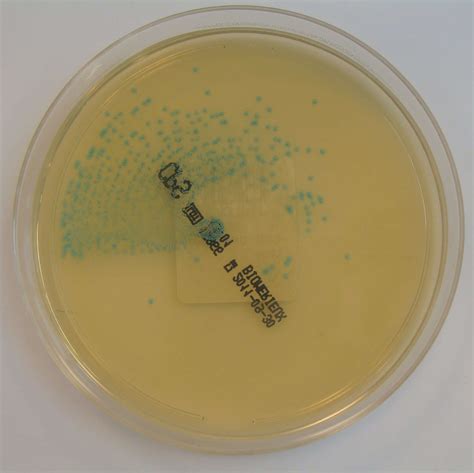 Enterococcus Faecalis On Chromid Cps Chromogenic Agar Encyclopedia Mdpi
