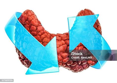 화살표와 함께 갑 하 상선 인간의 기능 치료 및 복구 개념입니다 흰색 배경에 고립 된 3 차원 렌더링 3차원 형태에 대한 스톡 사진 및 기타 이미지 Istock