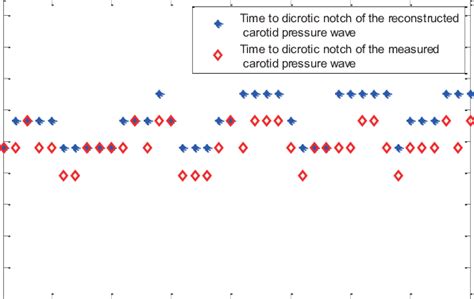 Comparison Of The Time From The Onset To Dicrotic Notch Of The