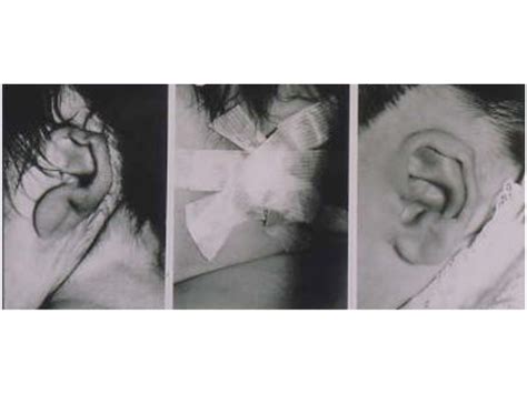 Ear Presentation Dr Robert Ruder