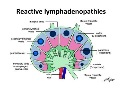Ppt Pathology 6 White Blood Cell And Lymph Node Disorders 1