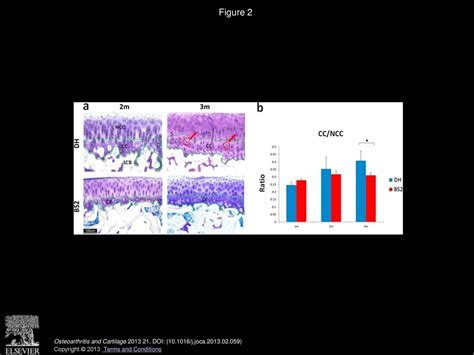 Early Chondrocyte Hypercellularity And Apoptosis May Be Correlated With