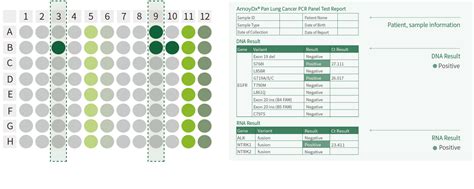 Amoydx® Automated Result Analysis Systemaras Amoydx
