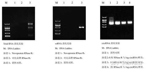 Gmp级rnase R重磅上线，环状rna那么火，你开始研究了吗？ 知乎