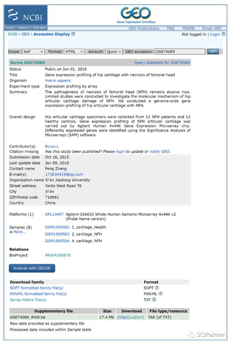 案例复现（一）：表达数据的下载与差异分析 知乎
