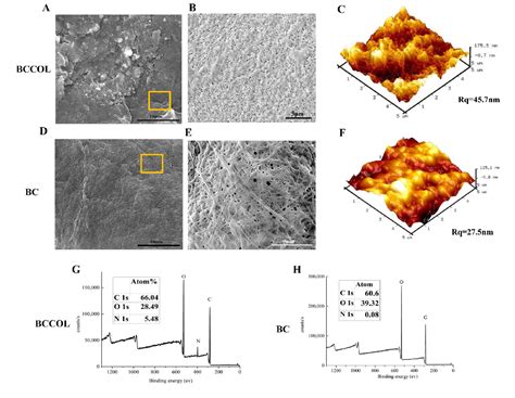 Figure From Development Of A Cellulose Based Prosthetic Mesh For Pelvic Organ Prolapse