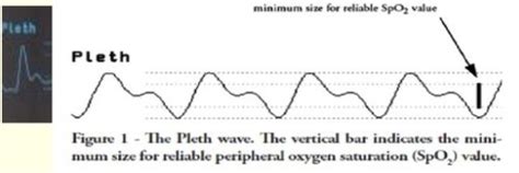 N624 Module 4 Oxygenation Flashcards Quizlet