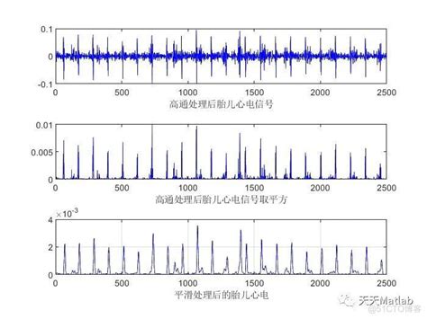 【心电信号ecg】基于nlms算法实现孕妇胎儿心电信号提取附matlab代码 csdn博客
