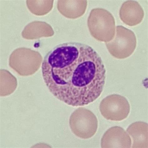 Eosinophils Identification And Differentiation