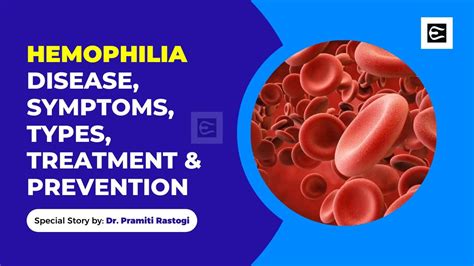 Hemophilia Disease Symptoms Types Treatment And Prevention Ebnw Story