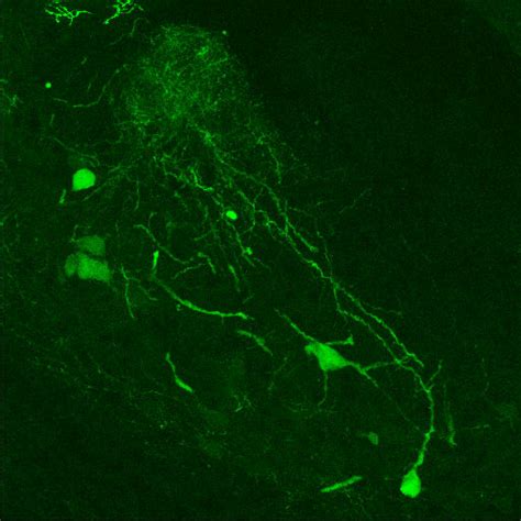 Gensat Project At Rockefeller University Mouse Brain Atlas Image